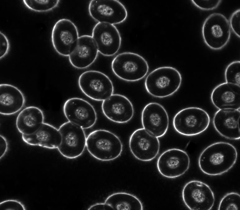 FROG_BLOOD_SMEAR_100x(oil)_darkfield_B-383DK000 – OPTIKAMICROSCOPES